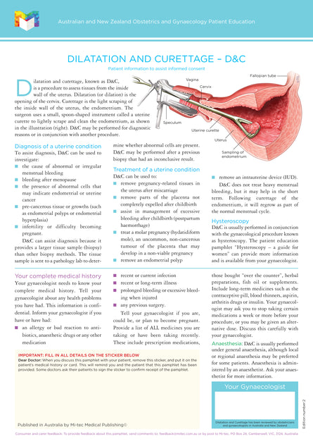 Dilatation And Curettage Dandc Mi Tec Medical Publishing