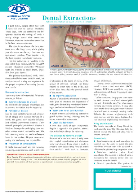 Dental Extractions – Mi-tec Medical Publishing