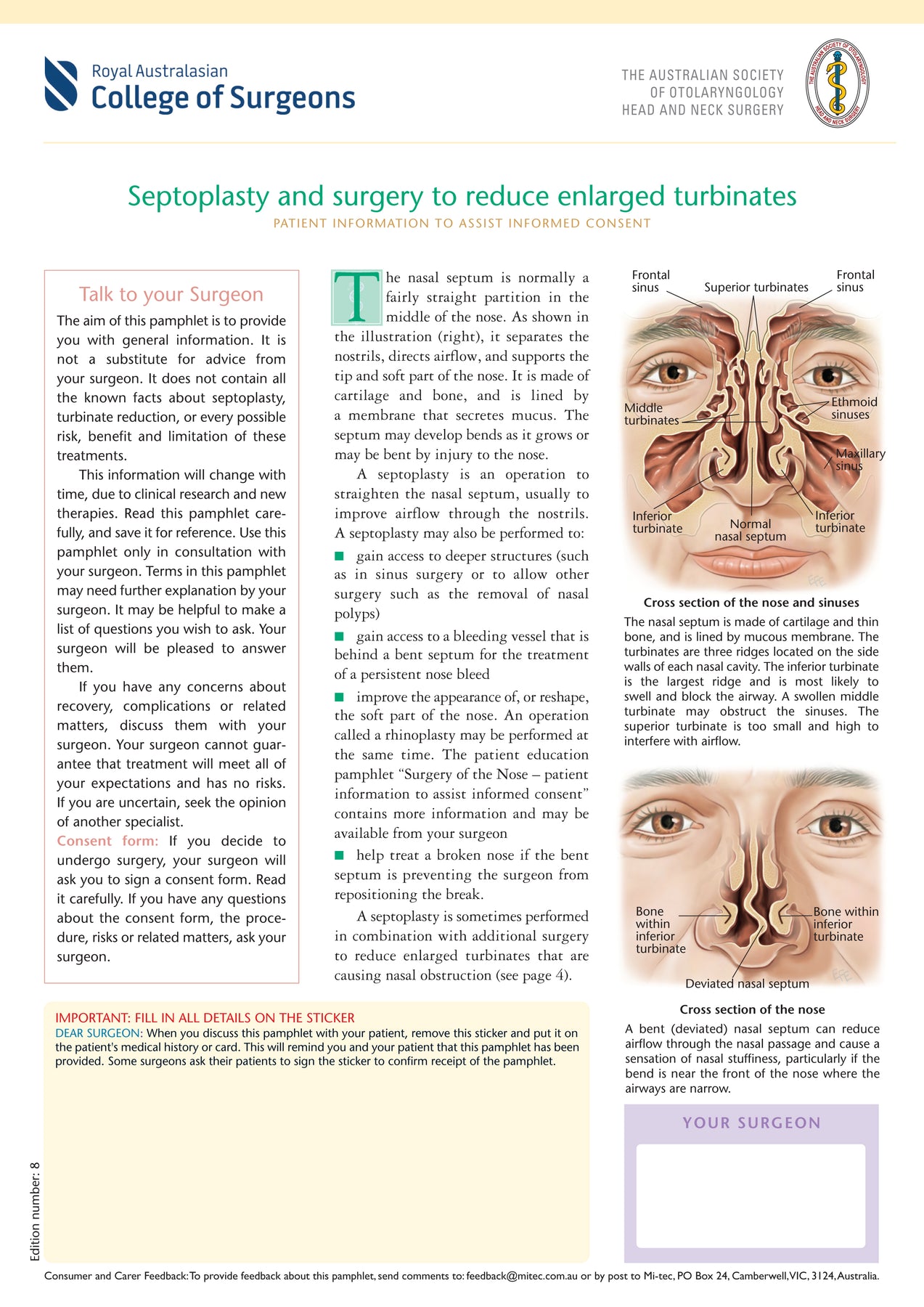 Septoplasty and Surgery to Reduce Enlarged Turbinates – Mi-tec Medical ...