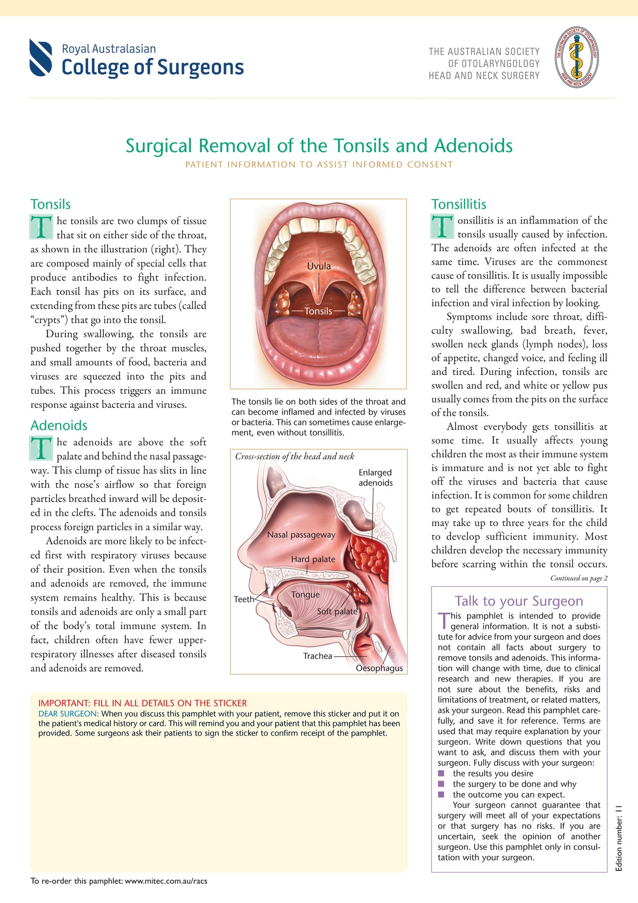 Surgical Removal of the Tonsils and Adenoids – Mi-tec Medical Publishing