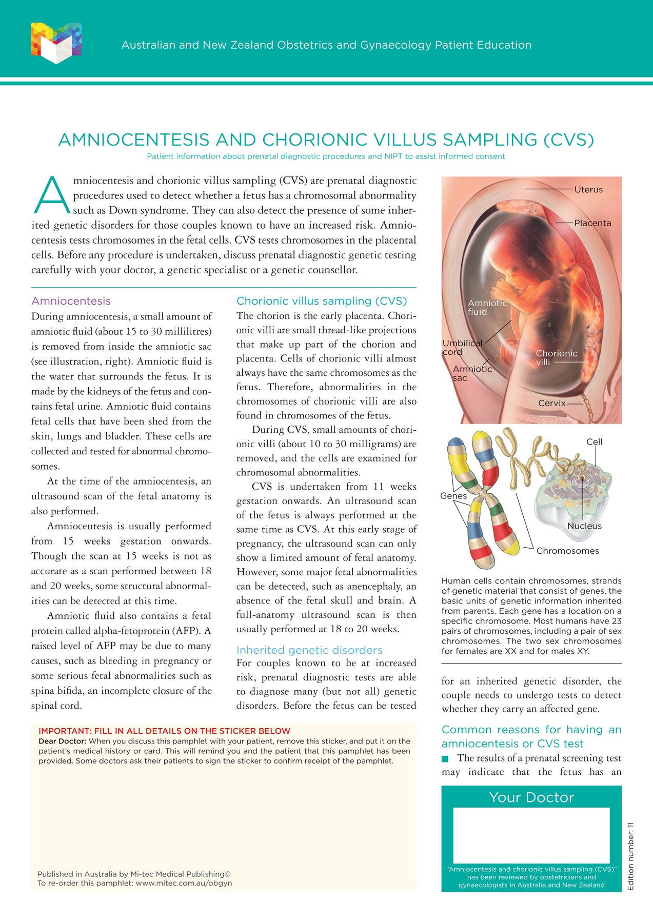 Amniocentesis And Chorionic Villus Sampling Cvs Mi Tec Medical