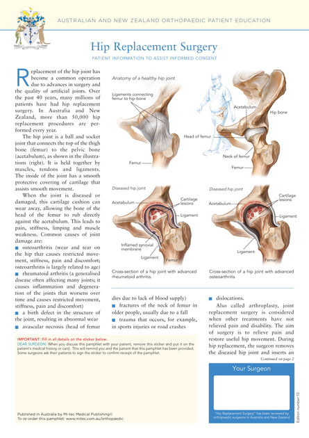 Hip Replacement Surgery – Mi-tec Medical Publishing
