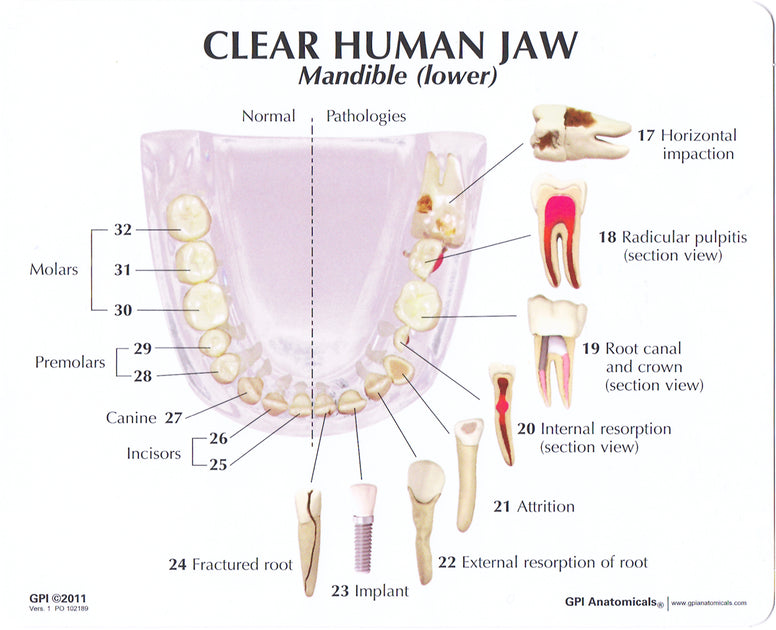 Clear Human Jaw With Teeth – Mi-tec Medical Publishing