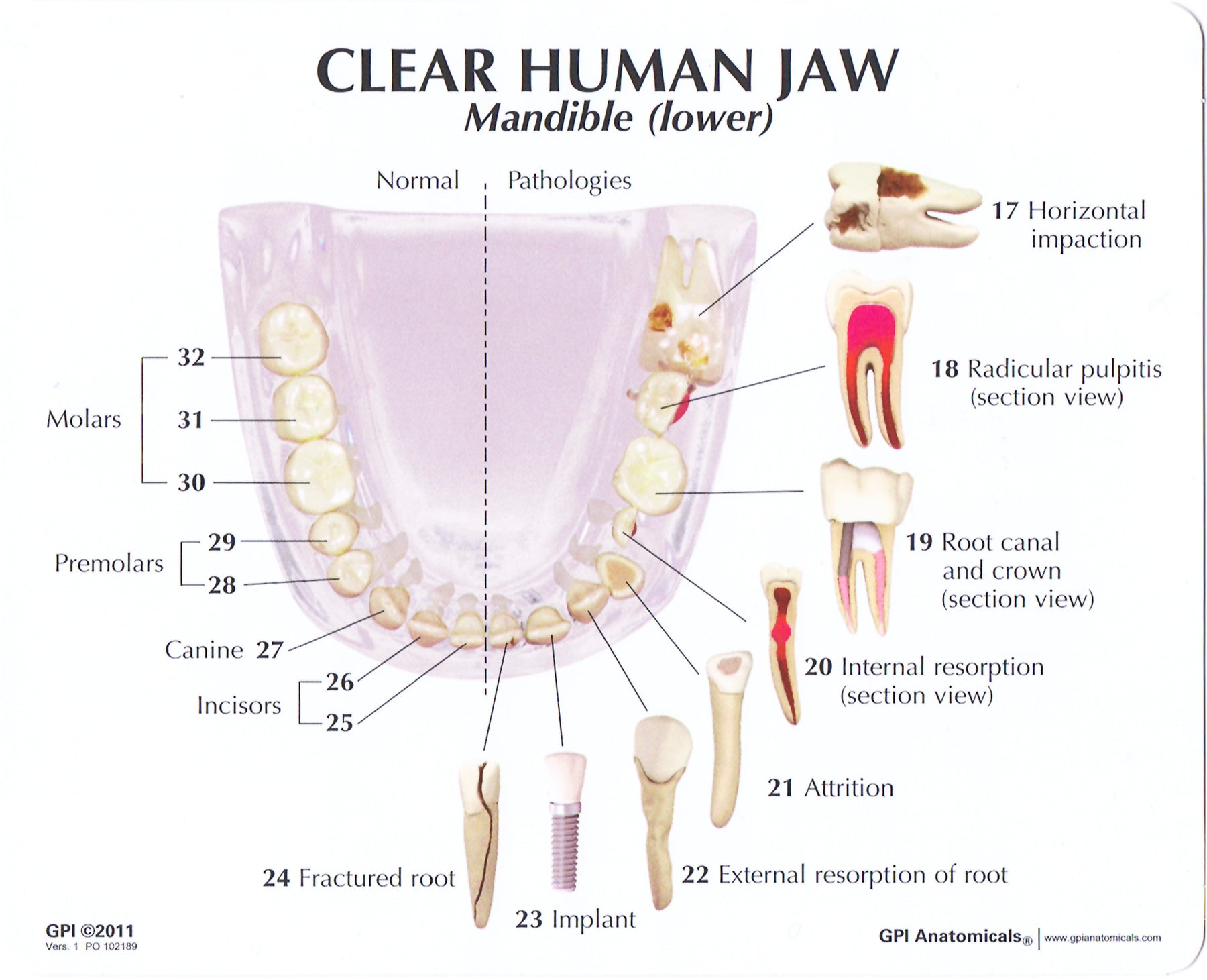 Dental Anatomical Models | Mi-tec Medical Publishing