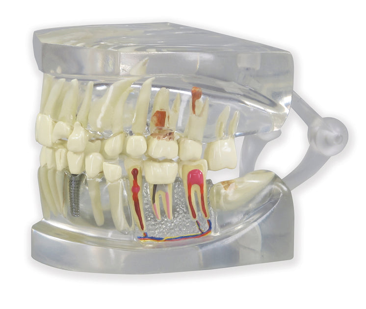 Dental Anatomical Models | Mi-tec Medical Publishing
