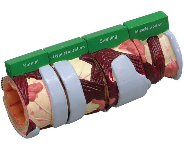 Surgical Anatomical Models – Mi-tec Medical Publishing
