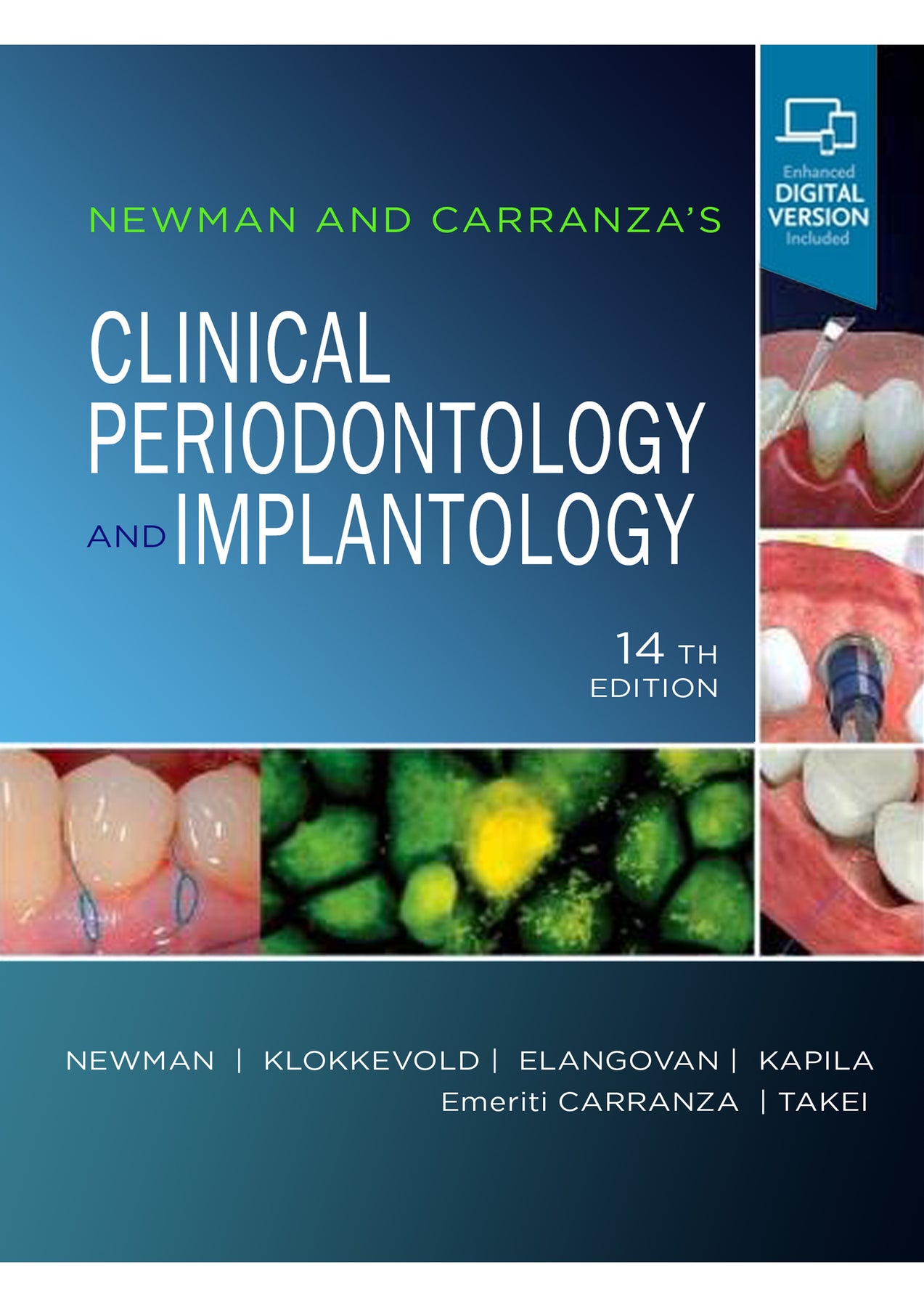 Newman and Carranza's Clinical Periodontology and Implantology 14th Ed ...