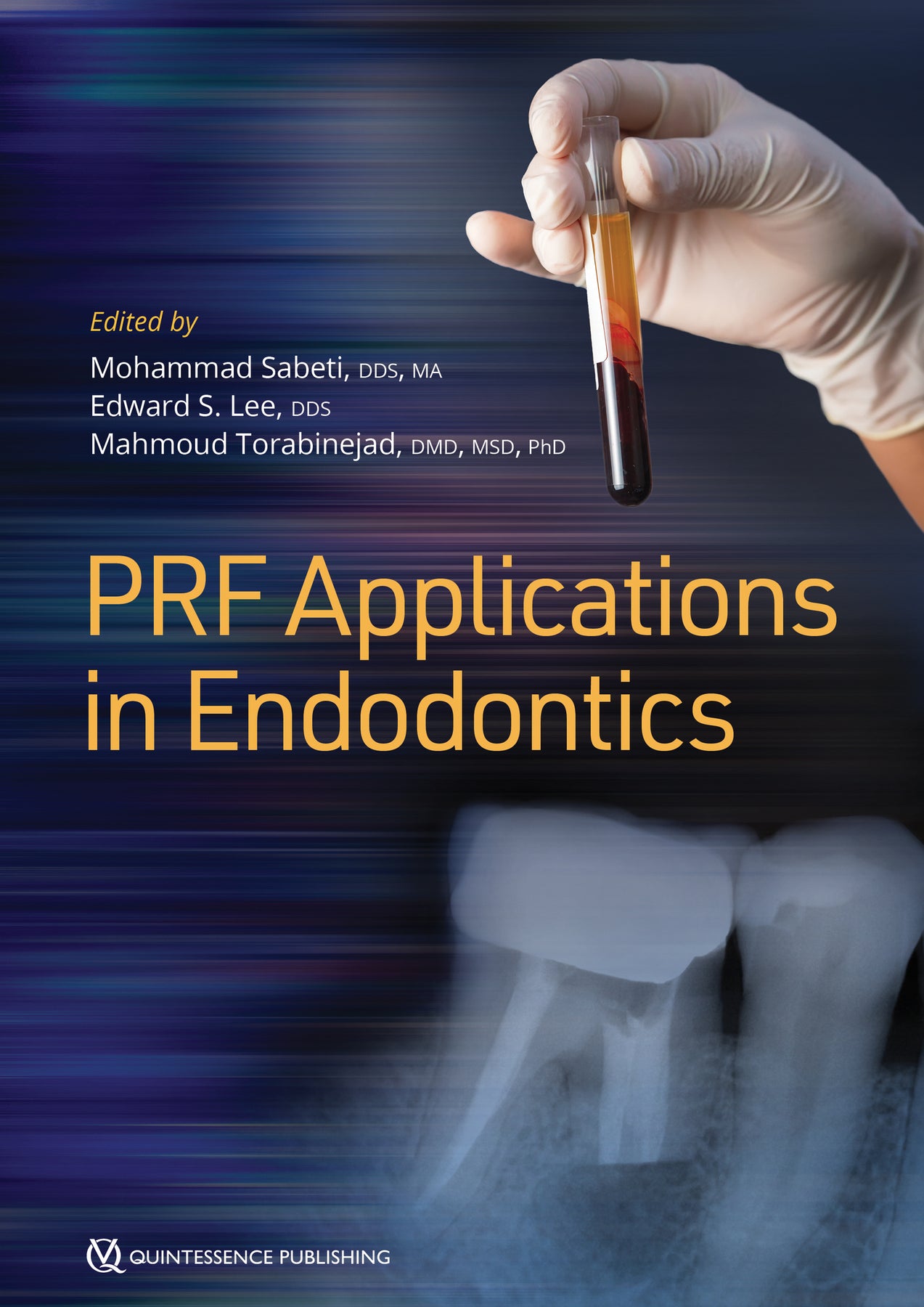 PRF Applications in Endodontics – Mi-tec Medical Publishing