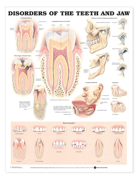 Disorders of the Teeth and Jaw Poster – Mi-tec Medical Publishing