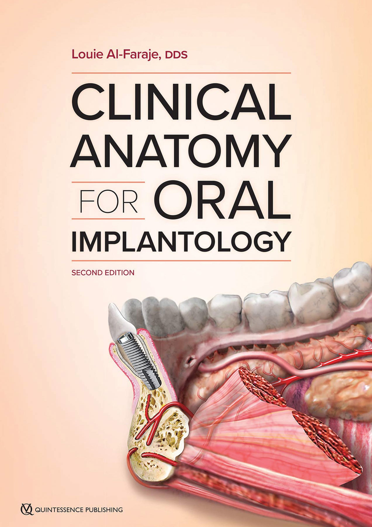 Clinical Anatomy for Oral Implantology, Second edition – Mi-tec Medical ...