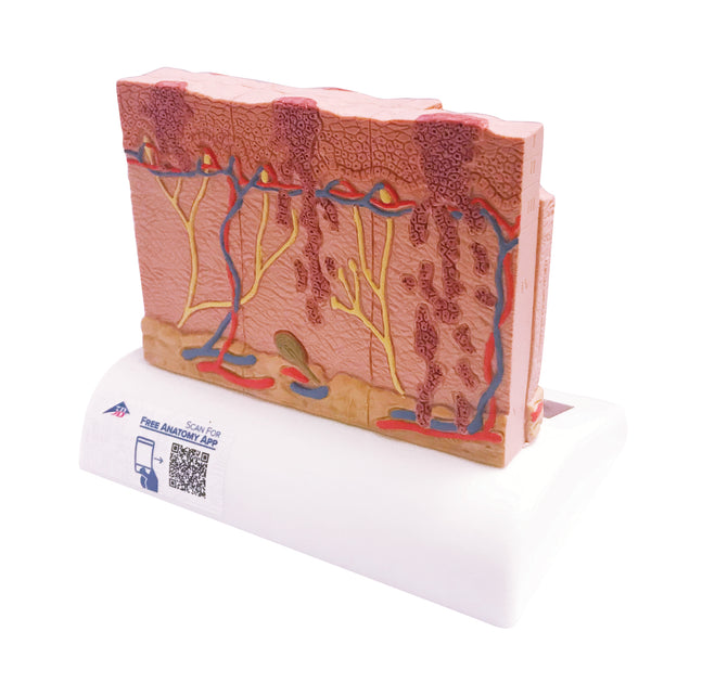 Skin Cancer Model – Mi-tec Medical Publishing