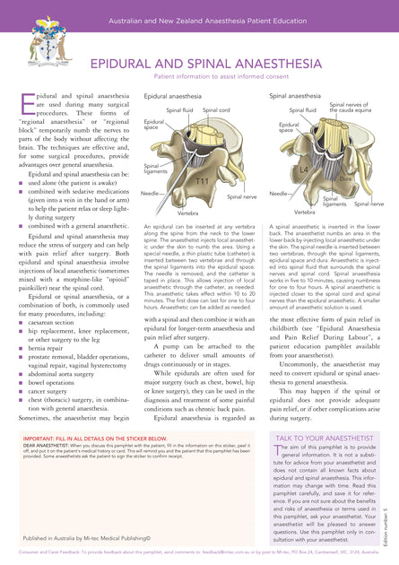 Epidural and Spinal Anaesthesia – Mi-tec Medical Publishing