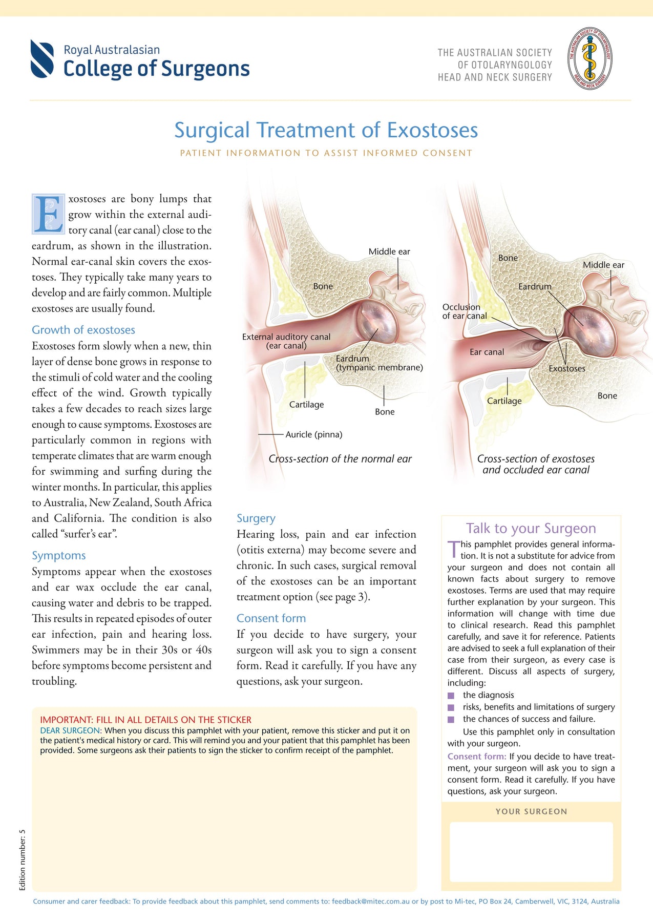 ASOHNS Patient Education Pamphlets | Mi-tec Medical – Mi-tec Medical ...