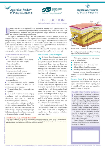 Liposuction – Mi-tec Medical Publishing