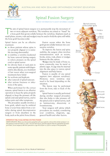 Spinal Fusion Surgery – Mi-tec Medical Publishing