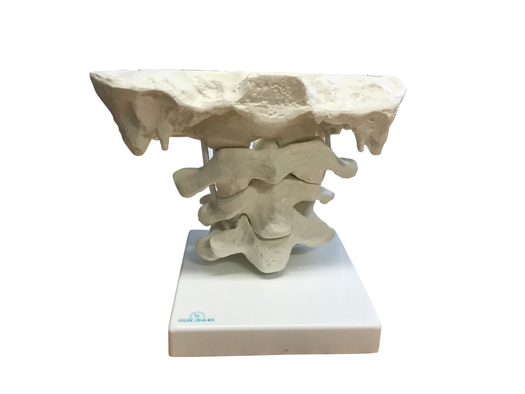 Giant Atlas / Axis Model – Mi-tec Medical Publishing